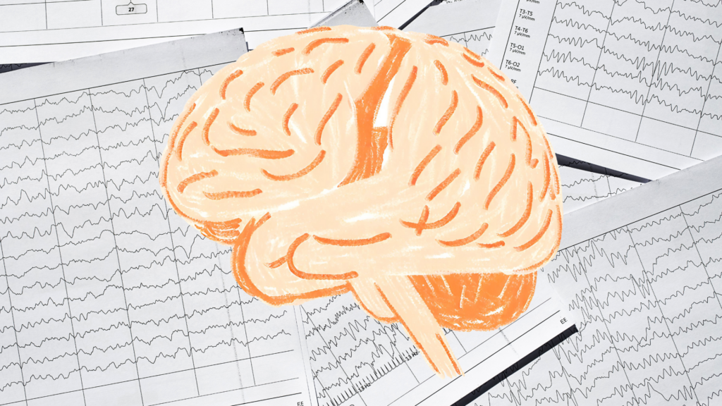 100 år med EEG - EEG-instituttet